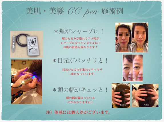 美肌・美髪 CC PENの回数券が出来ました！ - 京都・二条 美容院｜白髪染め・ノンジアミンカラー・トータルビューティーサロン VISAGE ...